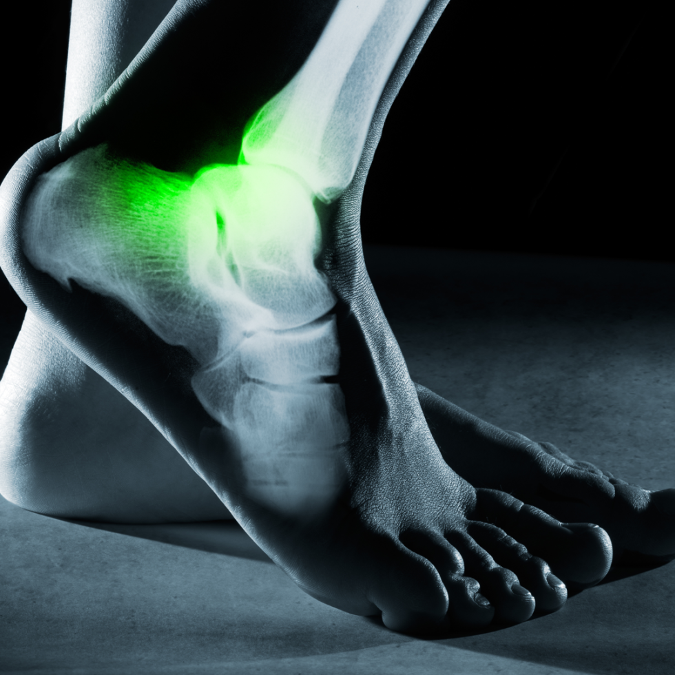 Foot & Ankle Training Online Training Course | Gray Institute